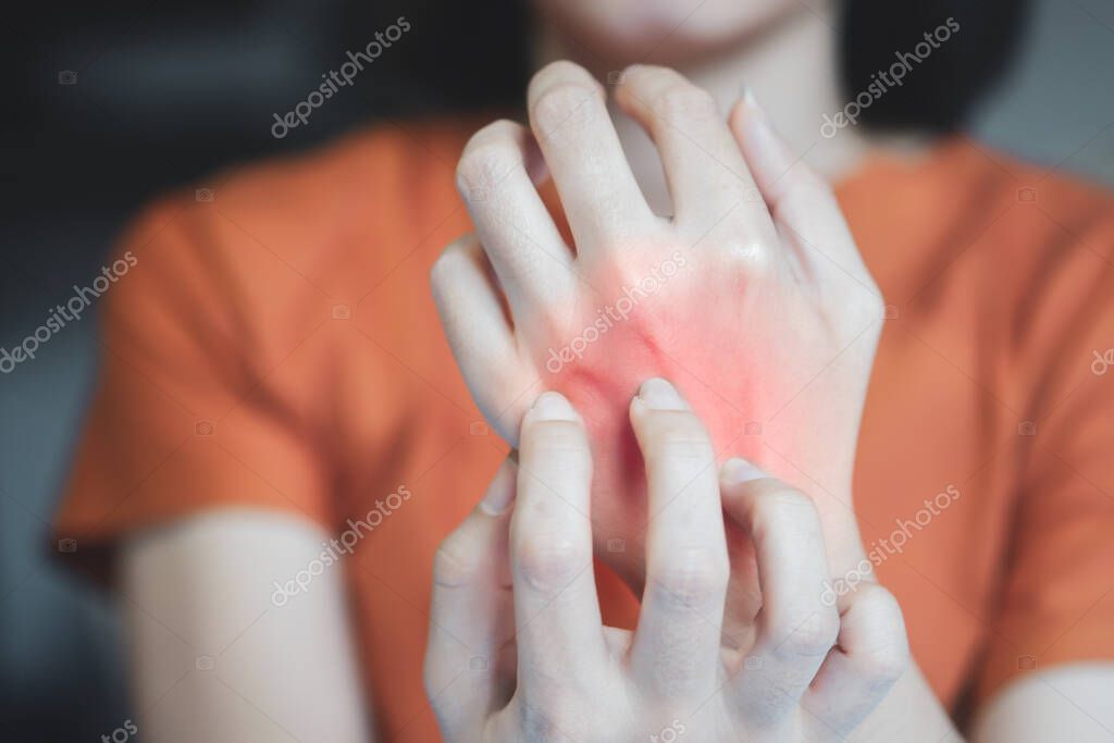 Las manos de una mujer tienen erupciones rojas, causando picazón debido ...