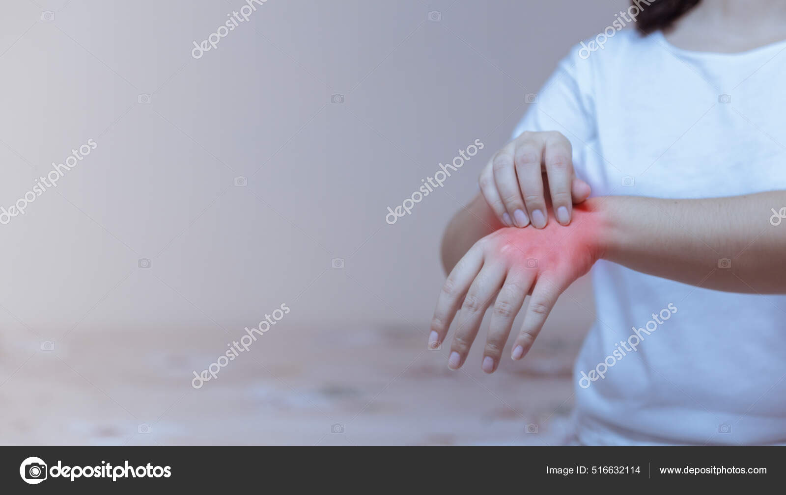 Mujer Rascarse Picazón Las Manos Reacción Alérgica Las Picaduras ...