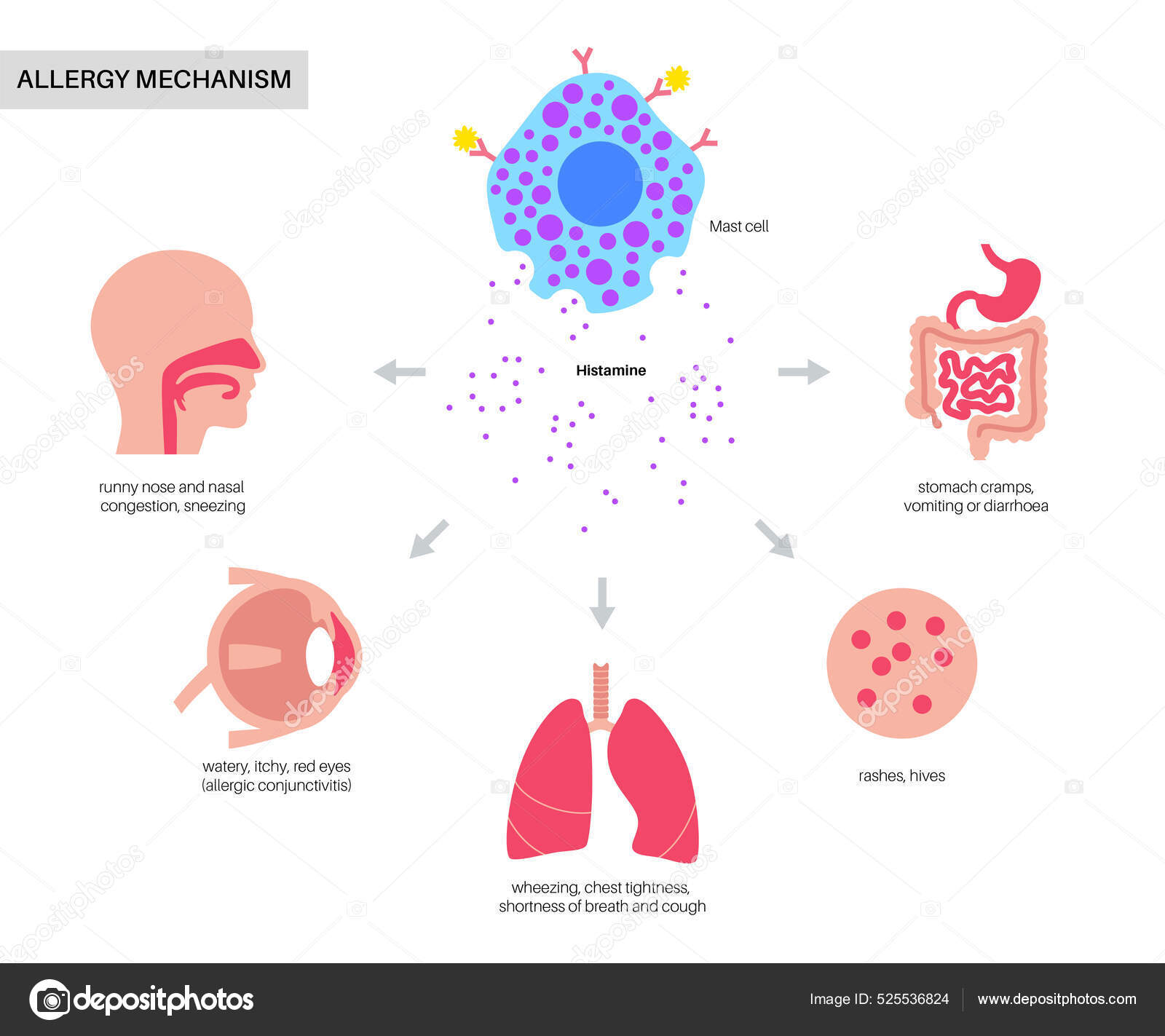 Allergy symptoms concept Stock Vector Image by ©Pikovit #525536824