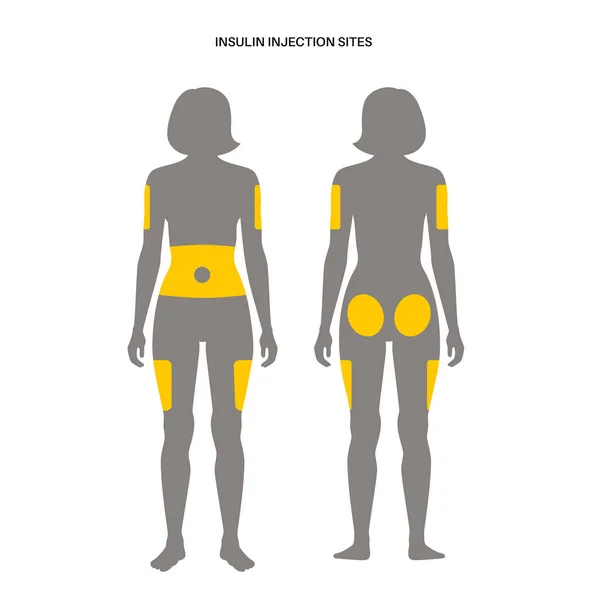 15 Buttock injection Stock Illustrations | Depositphotos®