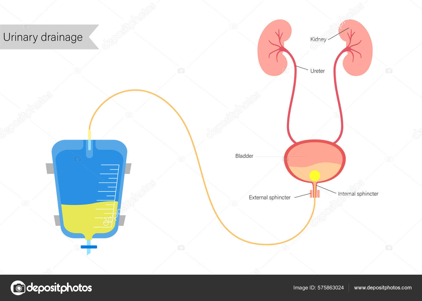 Kateter Urin Dalam Tubuh Manusia Kandung Kemih Kosong Dan Mengumpulkan ...