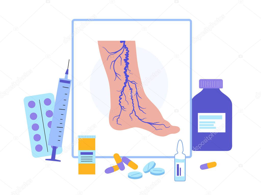 Concepto de venas varicosas. Hinchazón y dolor en las piernas humanas ...