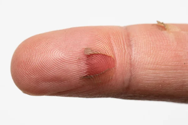 La cloque images libres de droit, photos de La cloque | Depositphotos