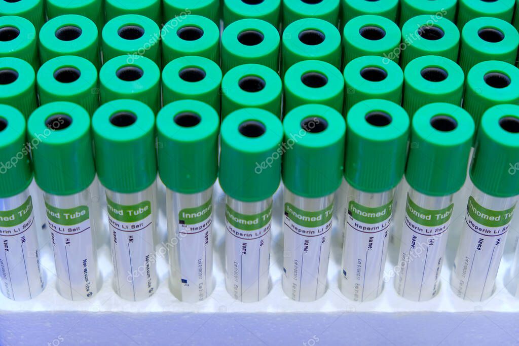 Primer plano y enfoque selectivo un grupo de tubo de muestra azul, tubo de muestra para mantener ...