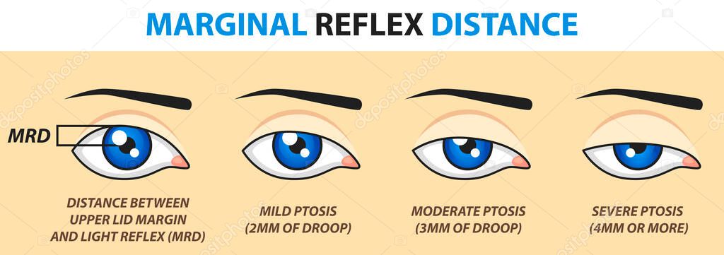 Neuromuscular Vector Art Stock Images | Depositphotos
