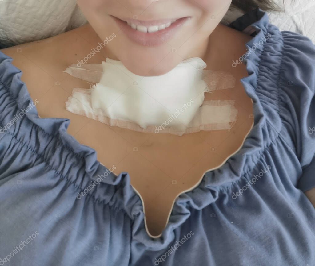 Cirugía tiroidea, cicatriz en el cuello. heridas quirúrgicas ...