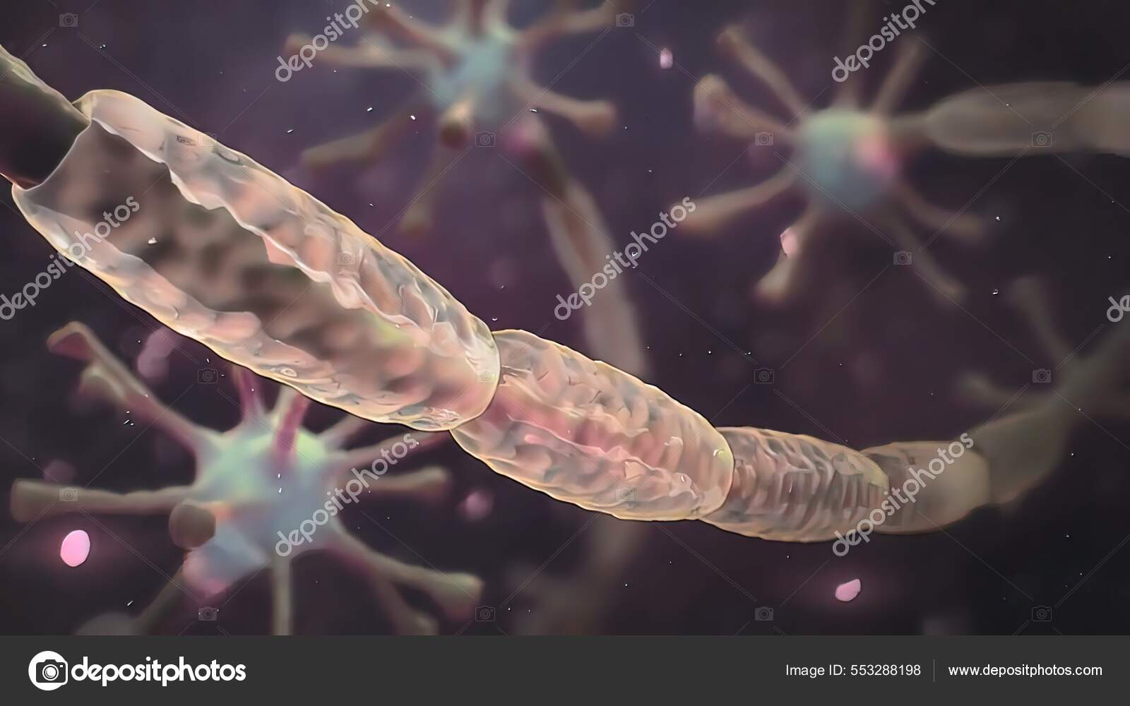 Neuron Research Exploding Degenerating Neuron Nervous System Research ...