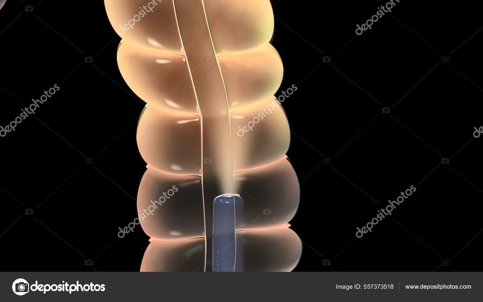 Colonoscopy Biopsy Gastrointestinal Tract Patients Illustration Stock ...