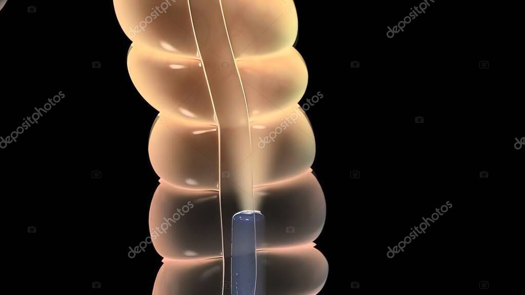 Biopsia de colonoscopia del tracto gastrointestinal en pacientes ...