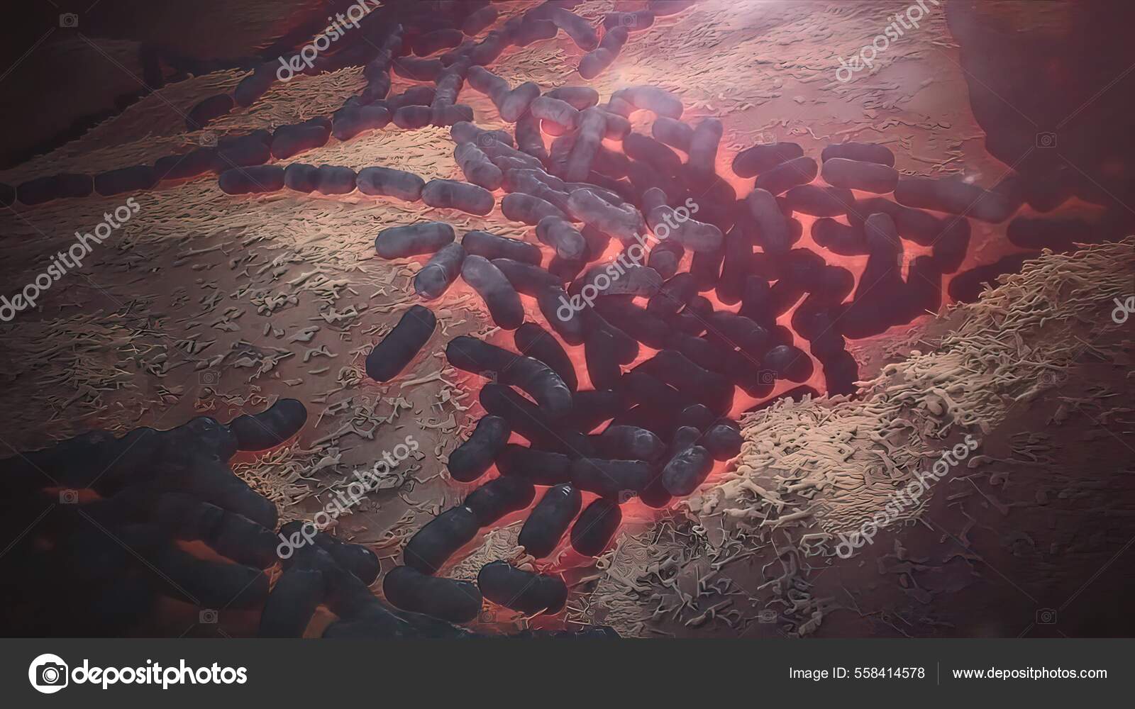 Illustration Helicobacter Pylori Gastritis Ulcers Causing Bacteria ...