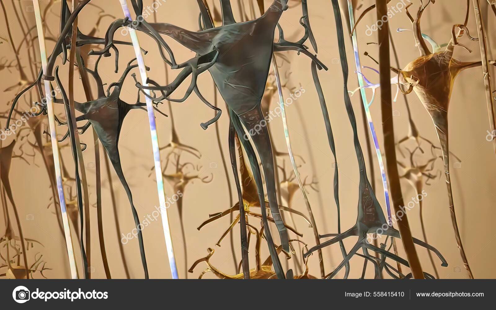 Diffuse Axonal Injury Affects Nerve Fibers Which Can Lead Disruption ...