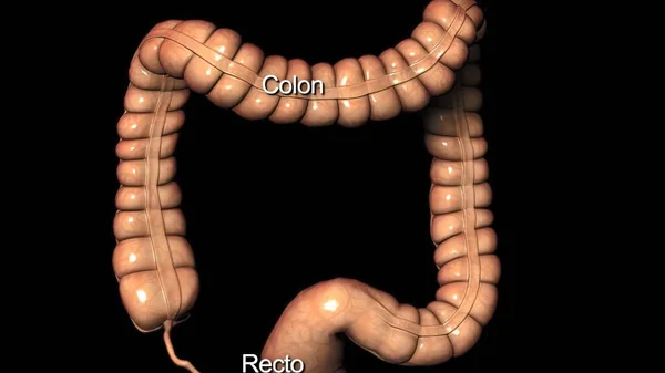 Intestino colon fotos de stock, imágenes de Intestino colon sin ...