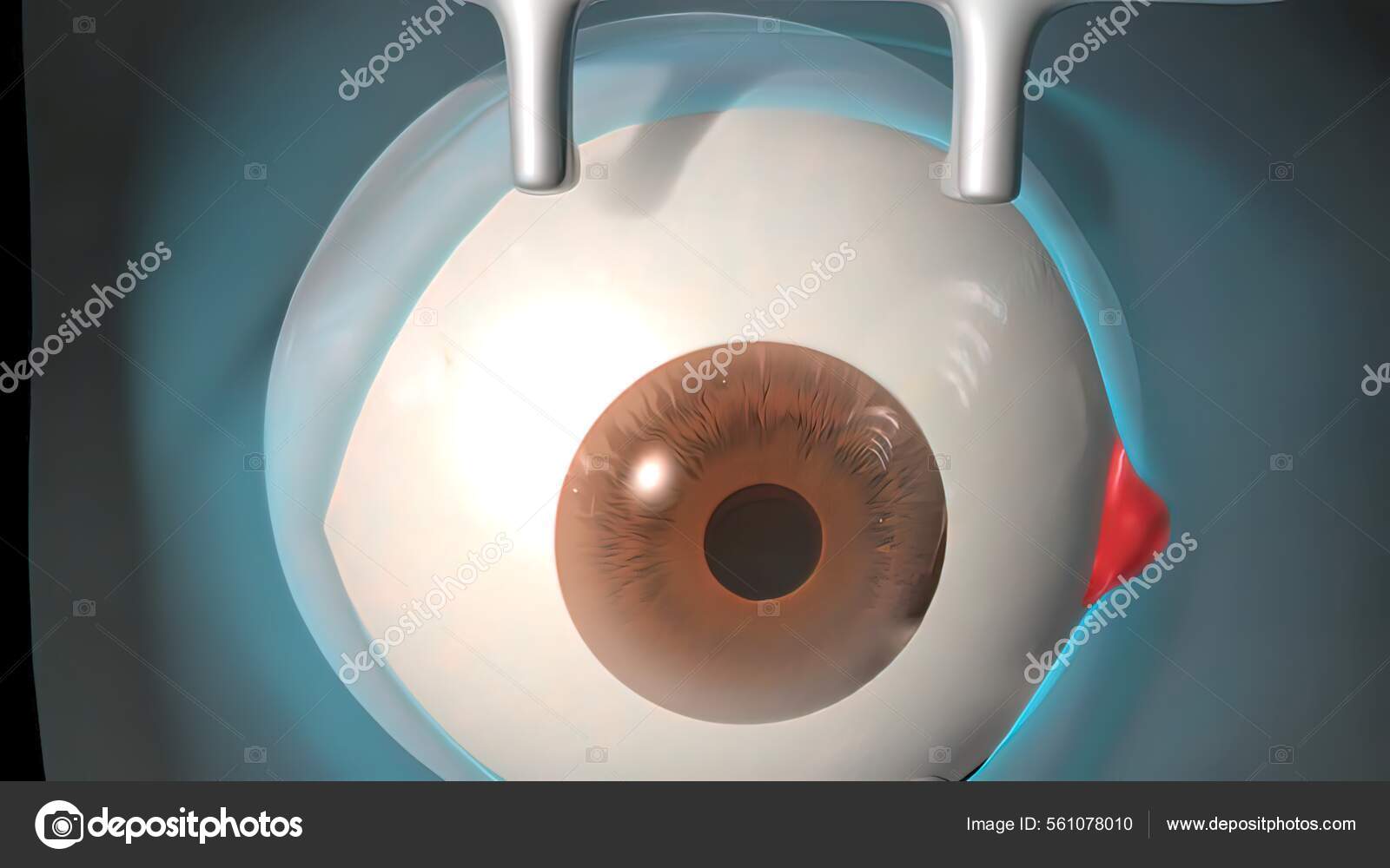 Cataract Surgery Application View Surgical Operations Human Eye ...
