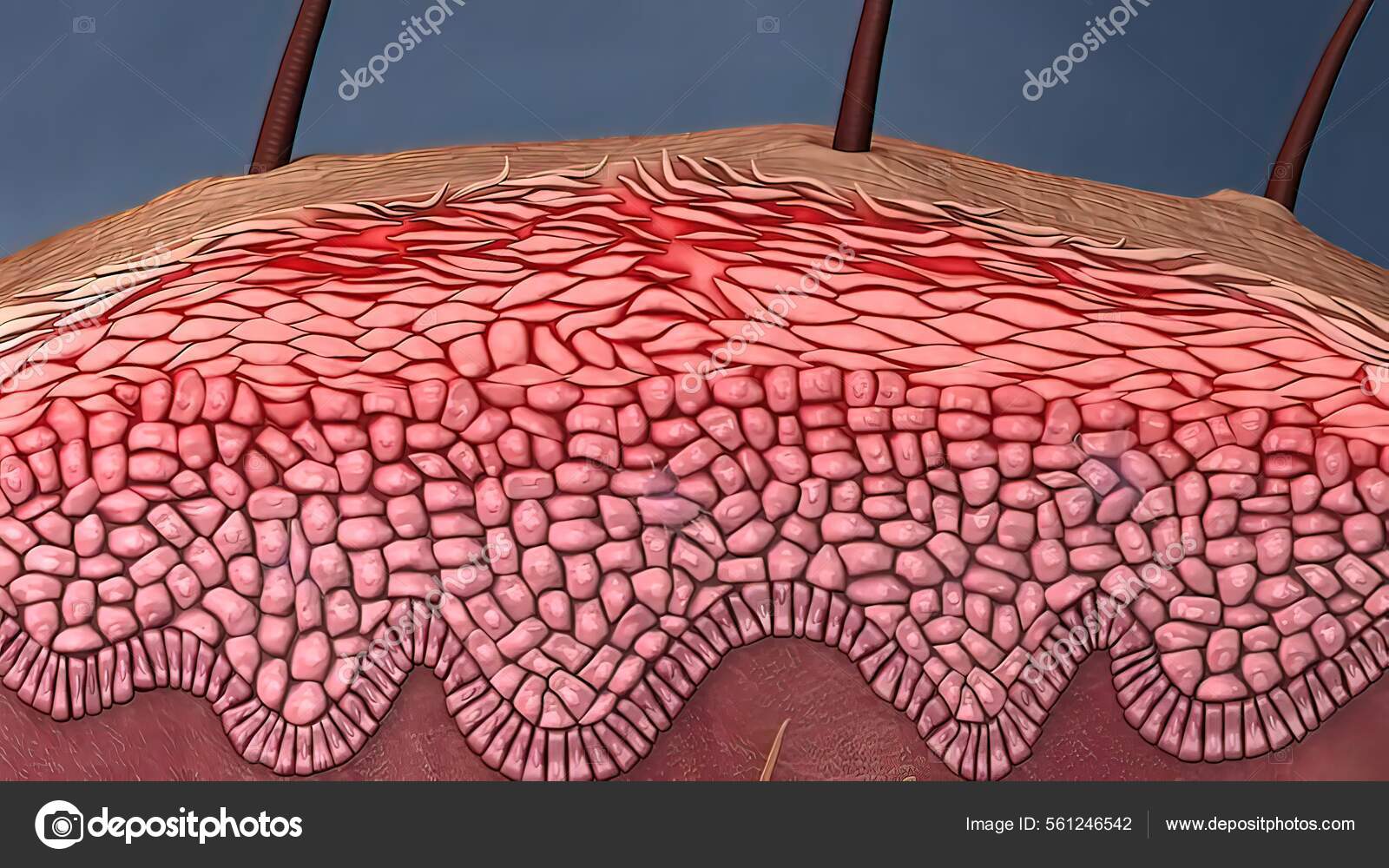 Attack Airborne Bacteria Skin Wound Activation Immune System ...
