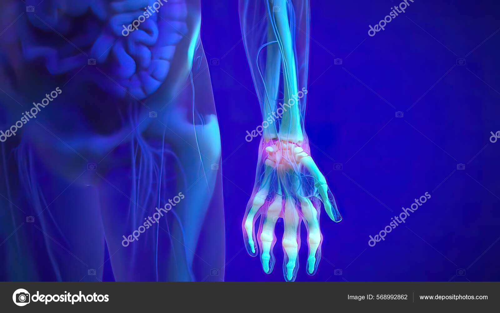 Pannus Abnormal Layer Fibrovascular Tissue Granulation Tissue ...