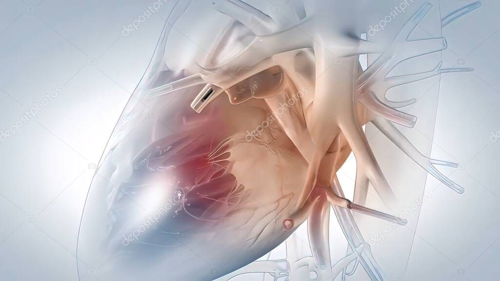 atrio izquierdo, una de las cuatro cavidades del corazón. La aurícula ...