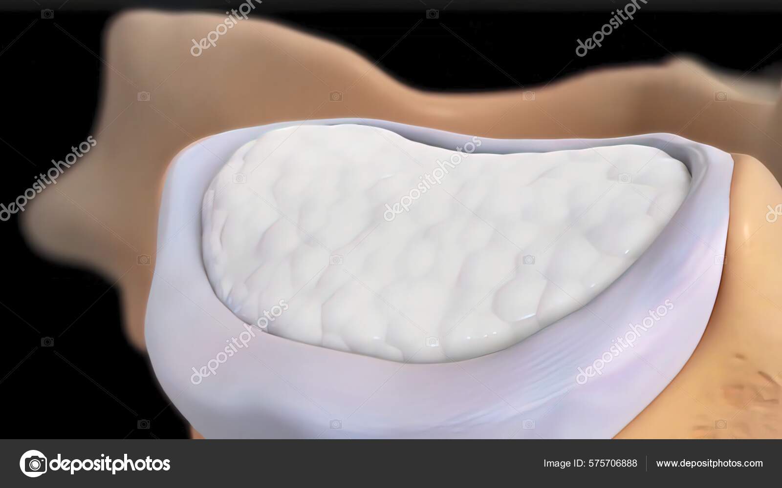 Nucleus Pulposus Inner Core Vertebral Disc Illustration Stock Photo by ...