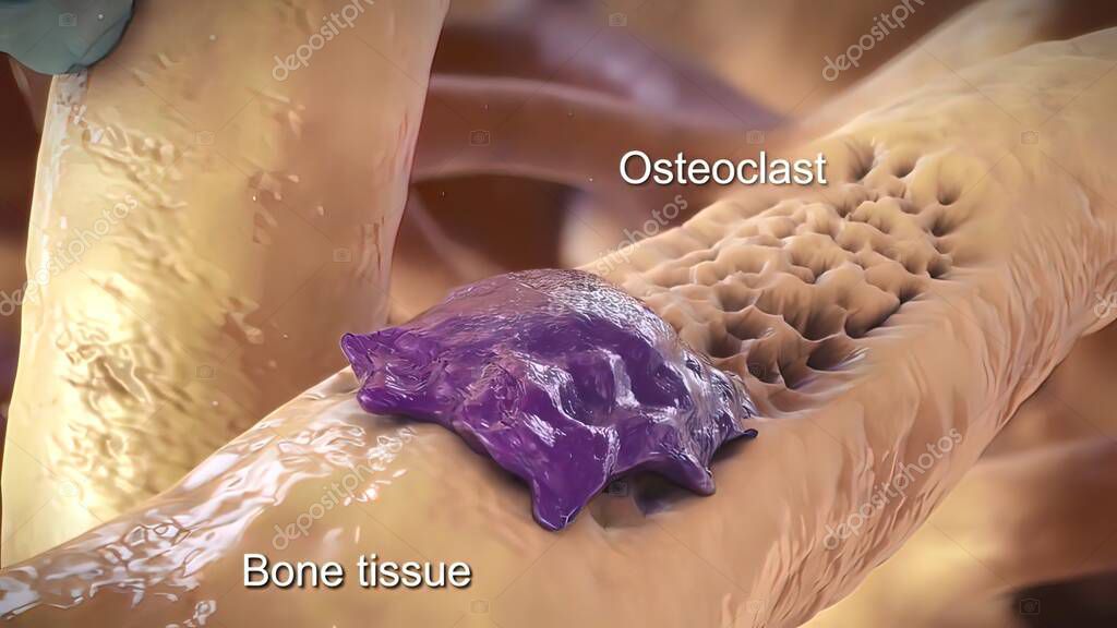 Tejido óseo, osteoclastos y osteoblastos. mientras que Osteoclast son ...