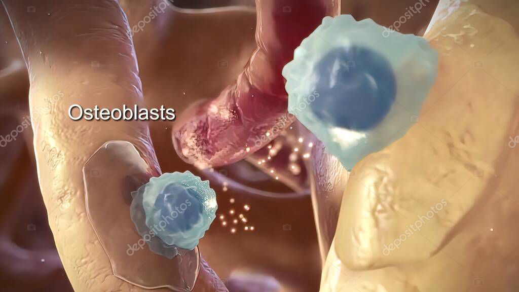 Tejido óseo, osteoclastos y osteoblastos. mientras que Osteoclast son ...