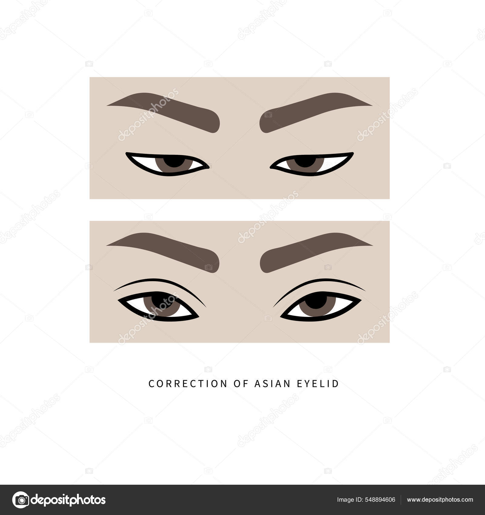 Asian Eyes Comparison
