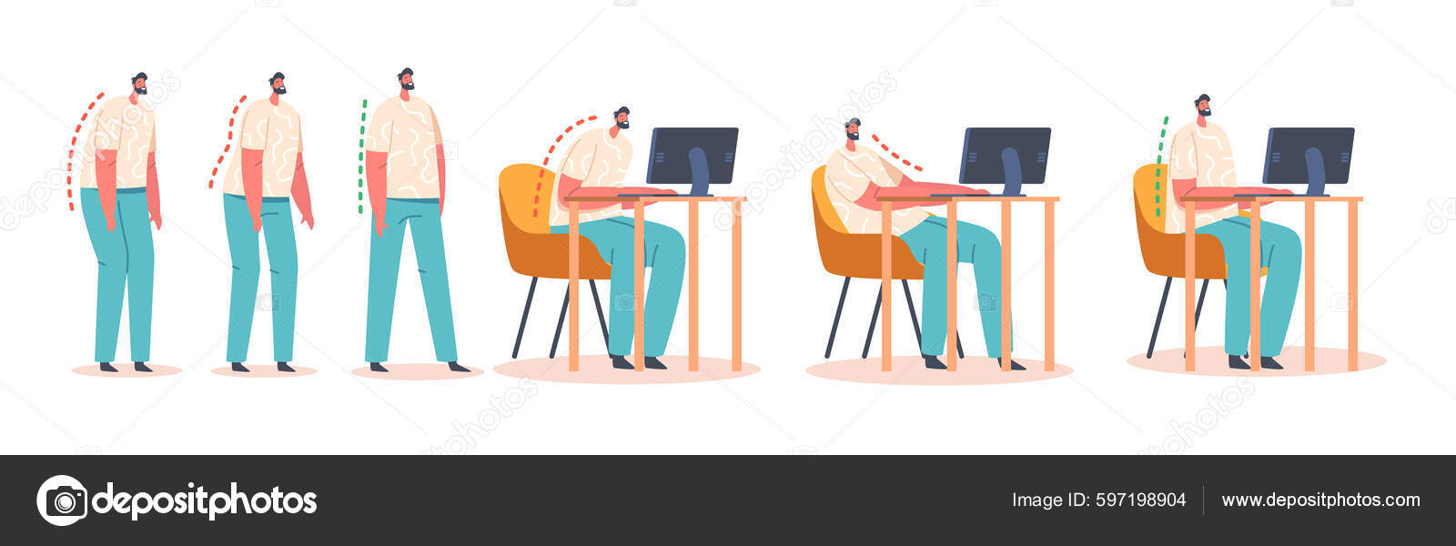 Image vectorielle Spinal Deformity Scoliosis Spine Backbone Curvature ...