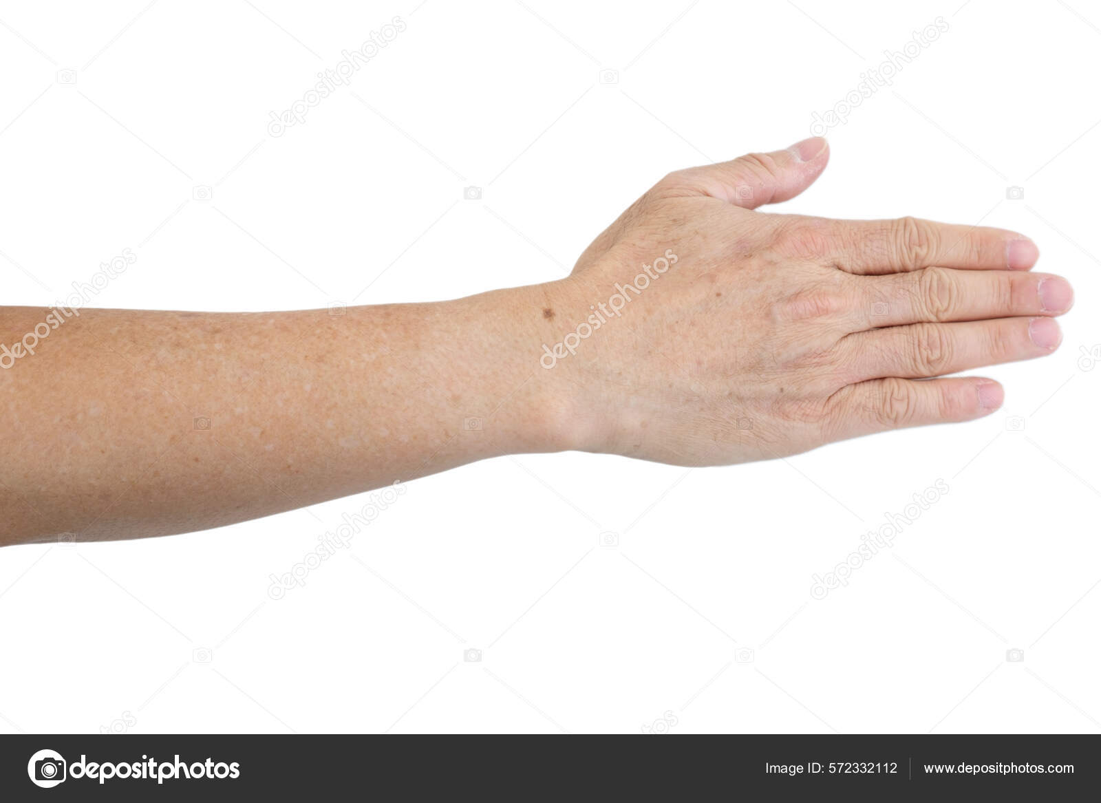 Small White Brown Spots Skin Senior Man Arm Idiopathic Guttate Stock ...