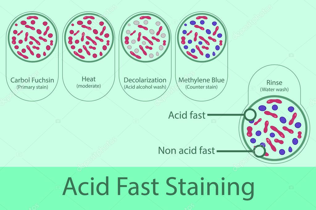Técnica de tinción rápida ácida pasos diagrama, utilizando Carbol ...