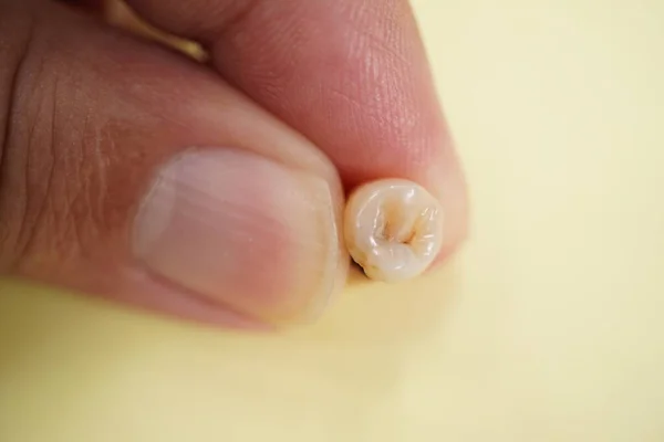 Real tooth Stock Photos, Royalty Free Real tooth Images | Depositphotos