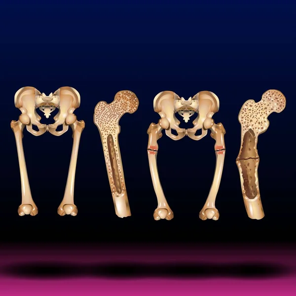 Structure of the pelvis. Anatomical poster of human skeleton. Pelvic ...