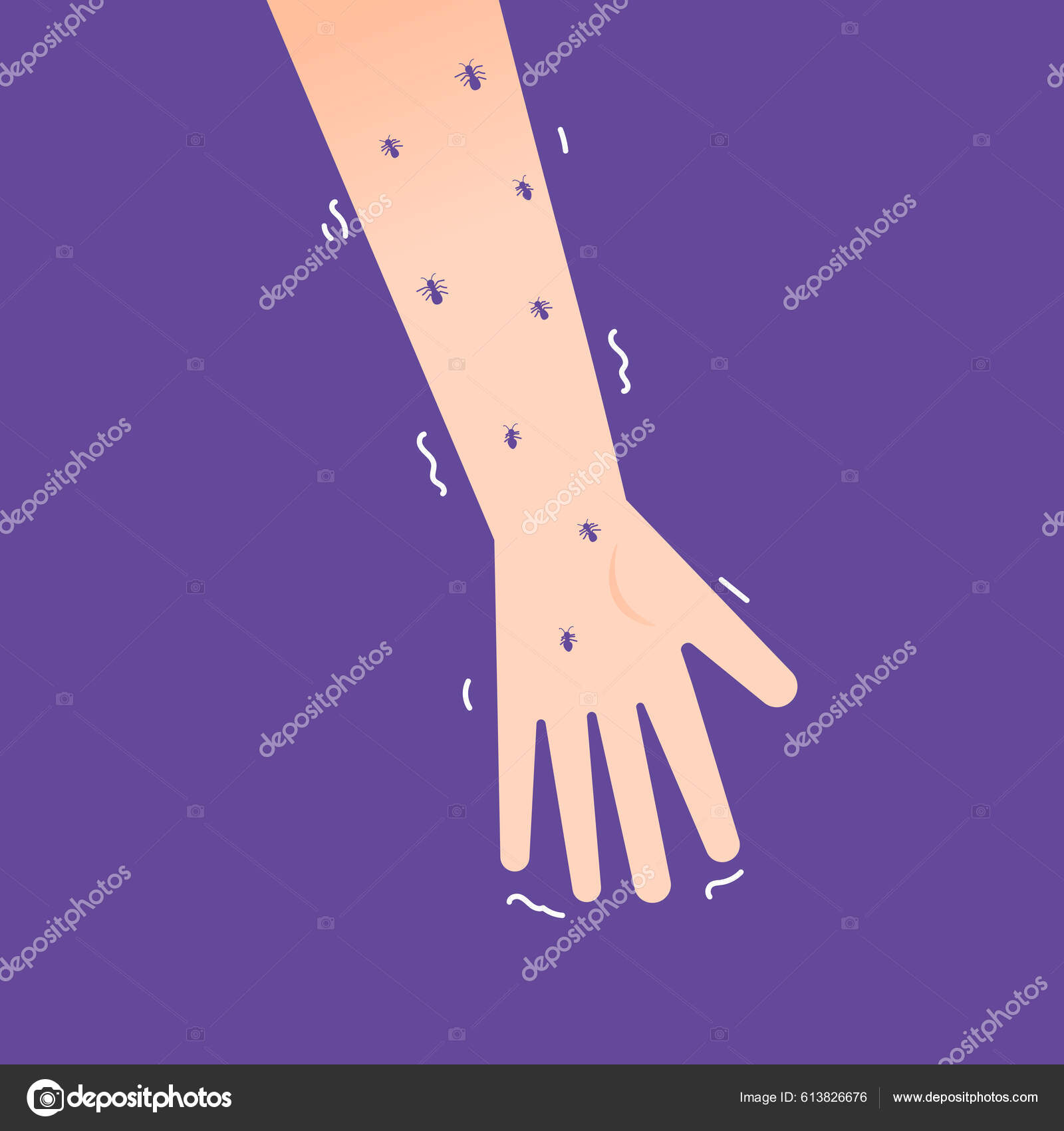 Hand Swarmed Ants Symptoms Tingling Paresthesias Tremors Hand Shaking ...