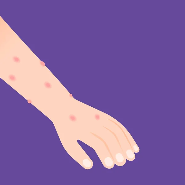 69 illustrations de Dermatologique | Depositphotos