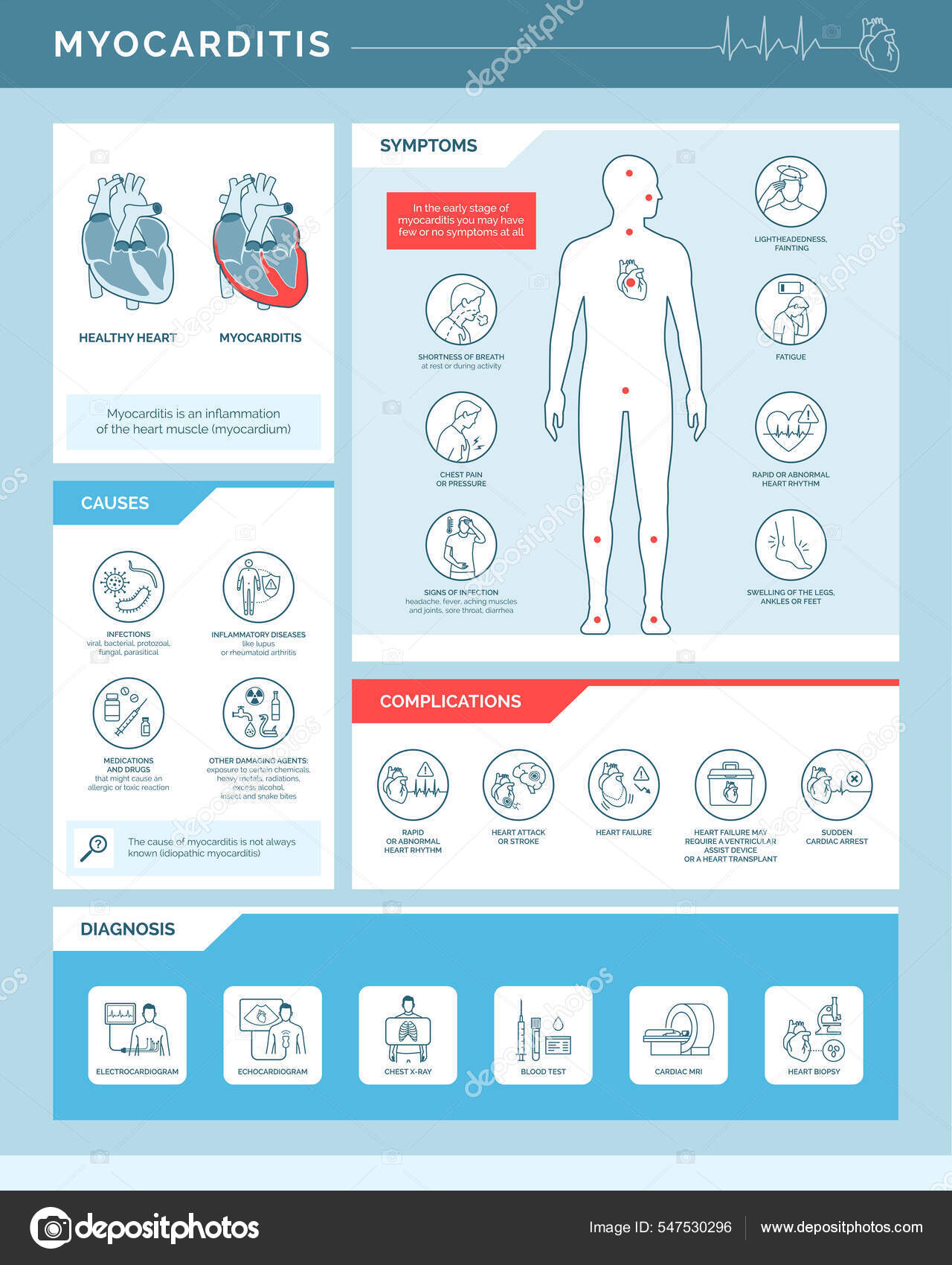 Myocarditis Heart Inflammation Causes Symptoms Complications Diagnosis ...