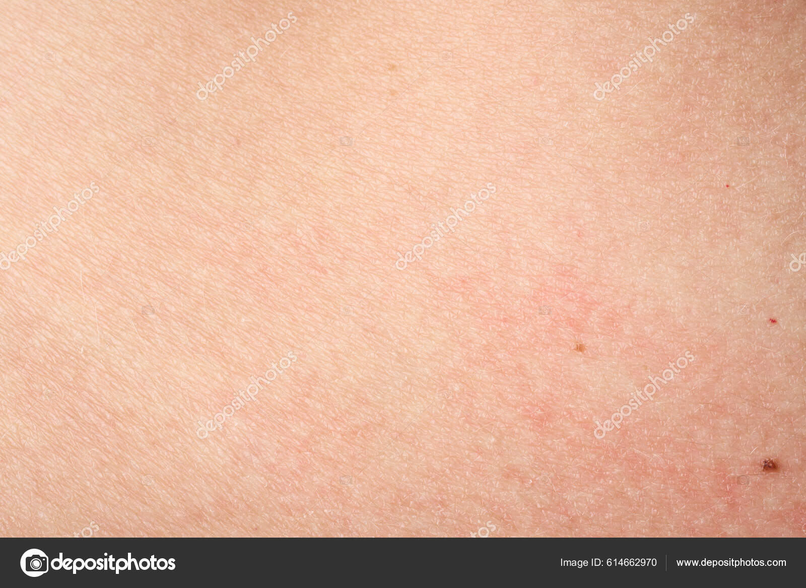 Background Pink Skin Texture Healthy Skin Macro Photo Skin Cells ...