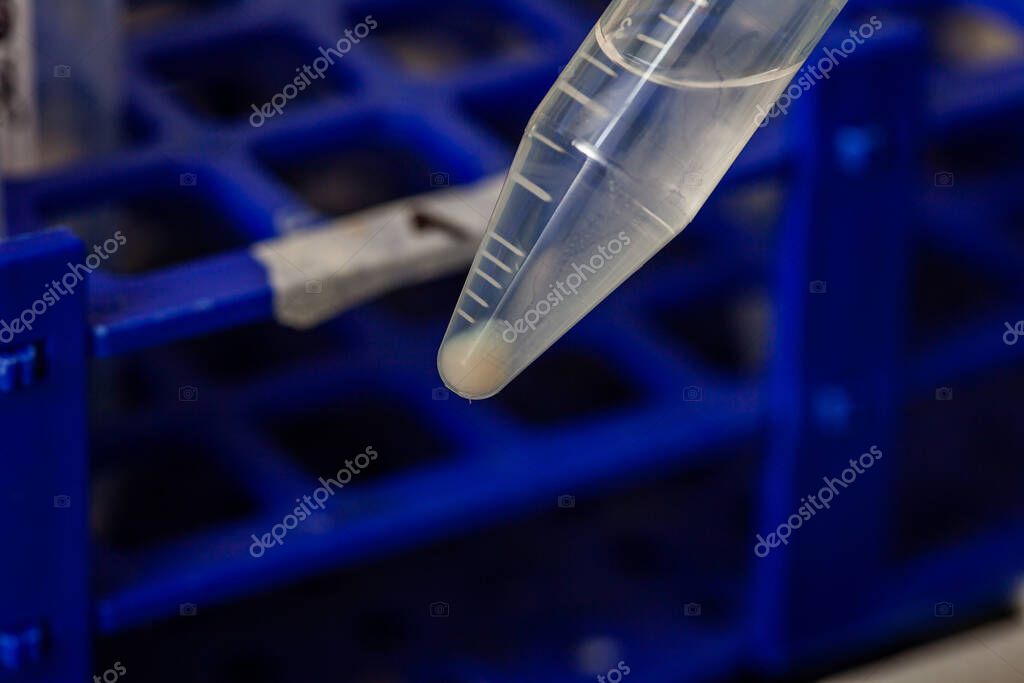 Tubo de ensayo con pellets de células sanguíneas obtenidos después de ...