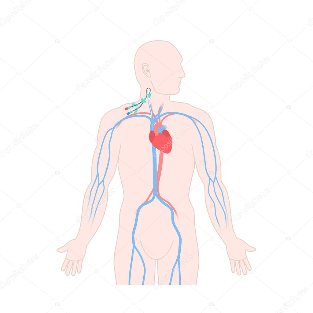 Catéter venoso central en la vena yugular Vector de stock por ©Naumas ...