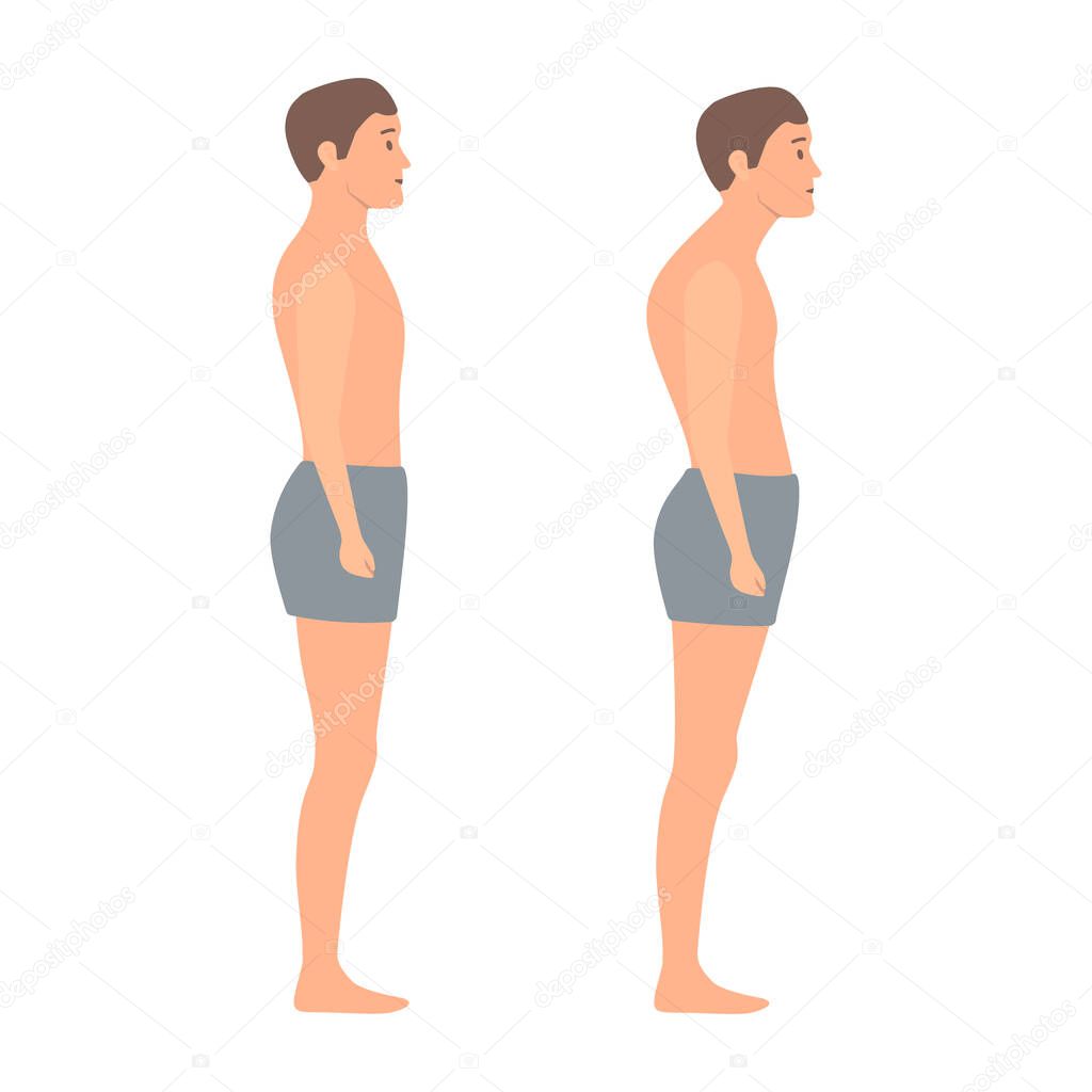 Good and bad posture on male body in side view. Spine curvature with ...