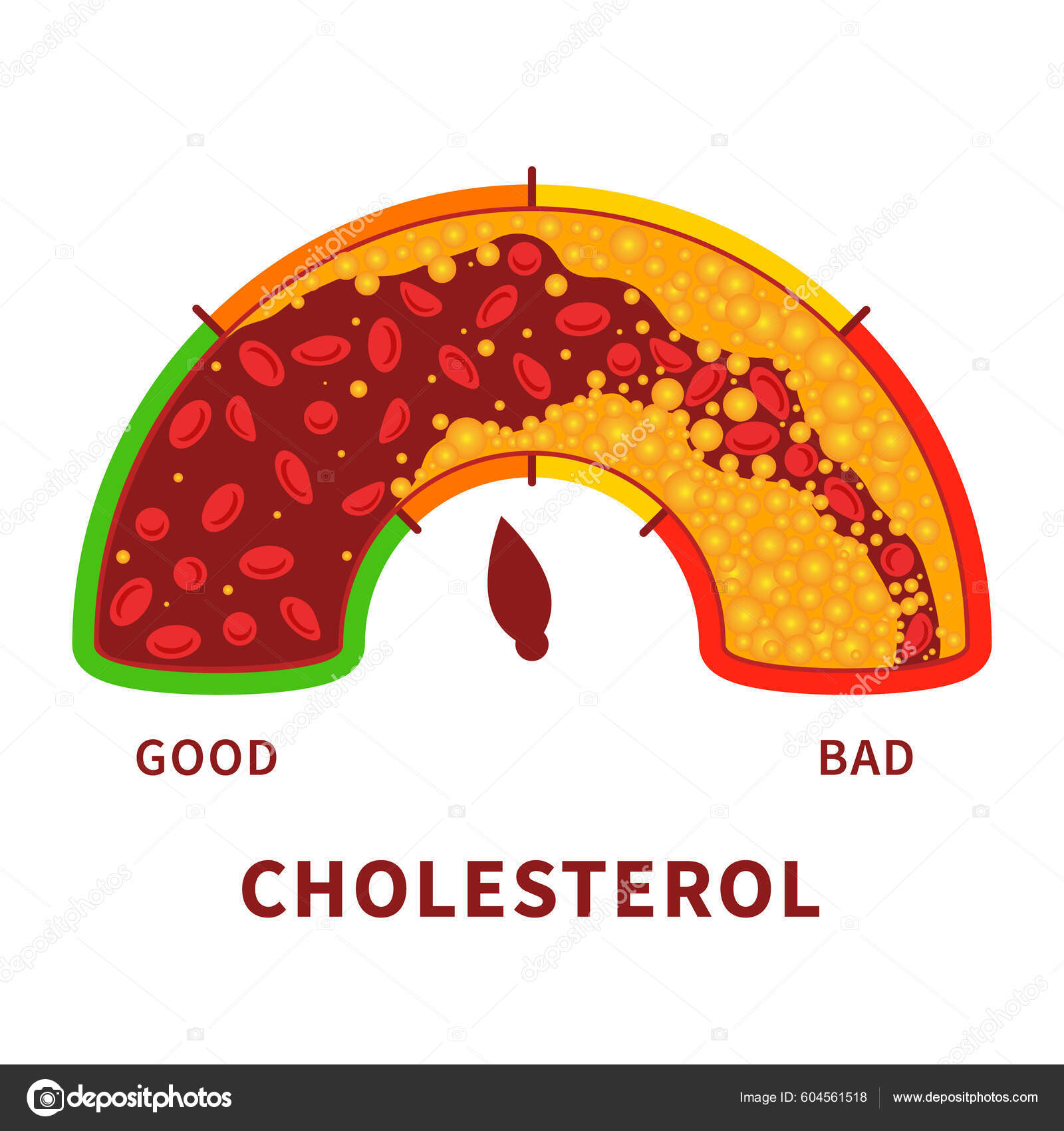 Cholesterol Level Blocked Blood Vessel Medical Diagram Meter Gauge Bad ...