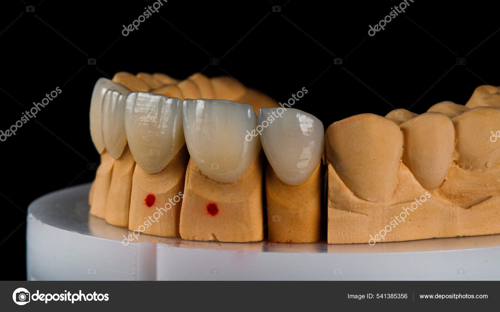 Four Ceramic Veneers Dental Models — Stock Photo © dendorstock #541385356