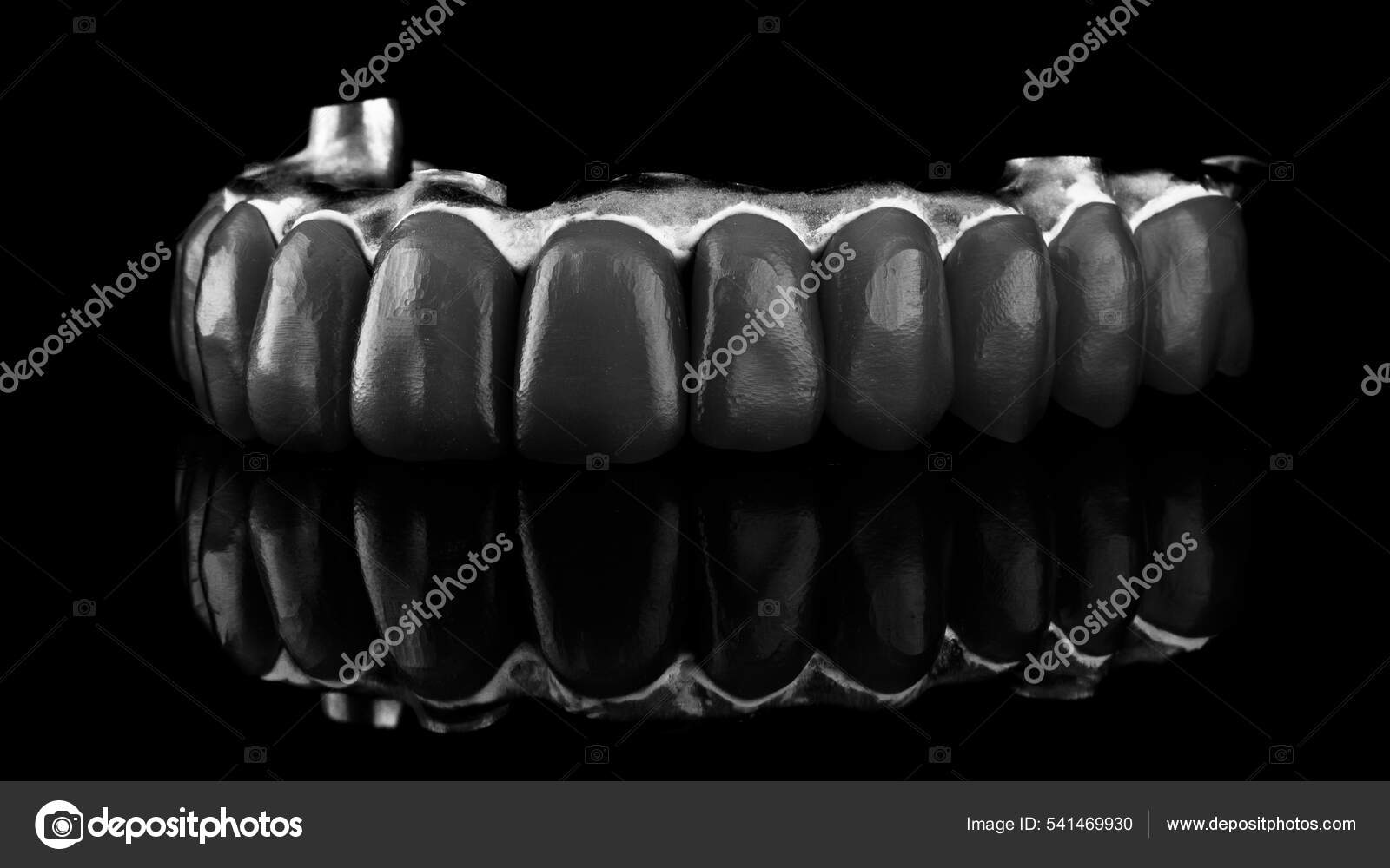 Dental Titanium Beam Blue Teeth Made Wax Try Patient's Smile — Stock ...