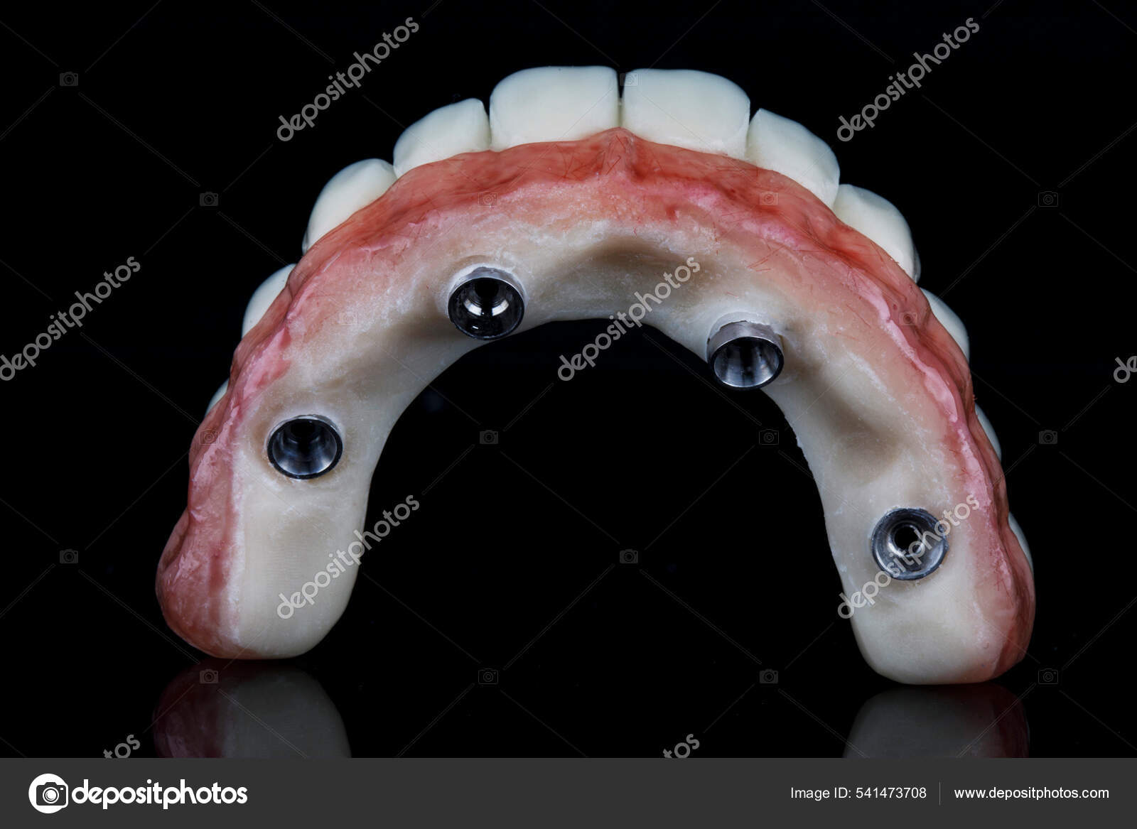 High Quality Denture Upper Jaw Pink Gum Fixation Side Shot — Stock ...
