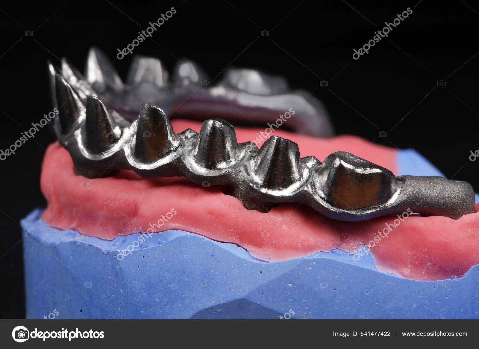 Titanium Beam Model Pink Gum Fixation Accuracy Black Background — Stock ...