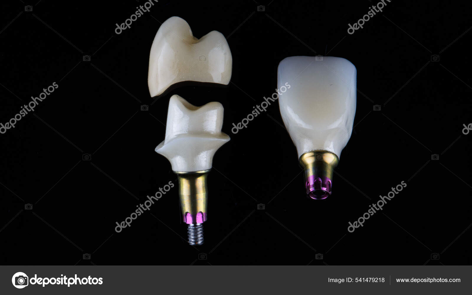 Complete Dental Crown Separate Crown Special Ceramic Base Filmed Black ...