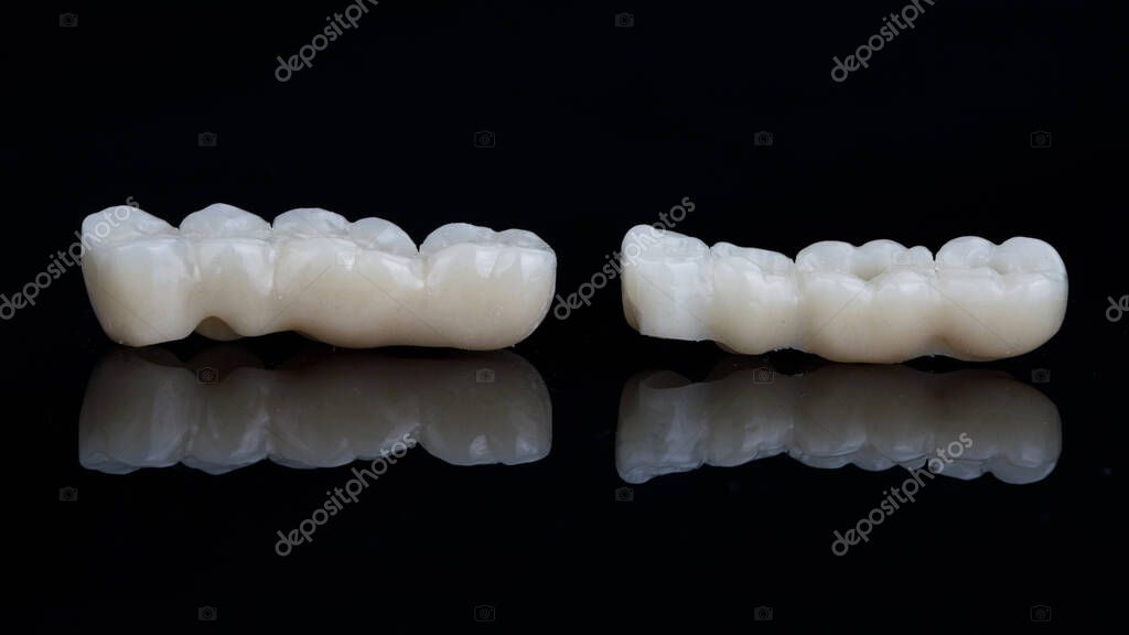 puentes dentales temporales para masticar dientes hechos de polímero ...