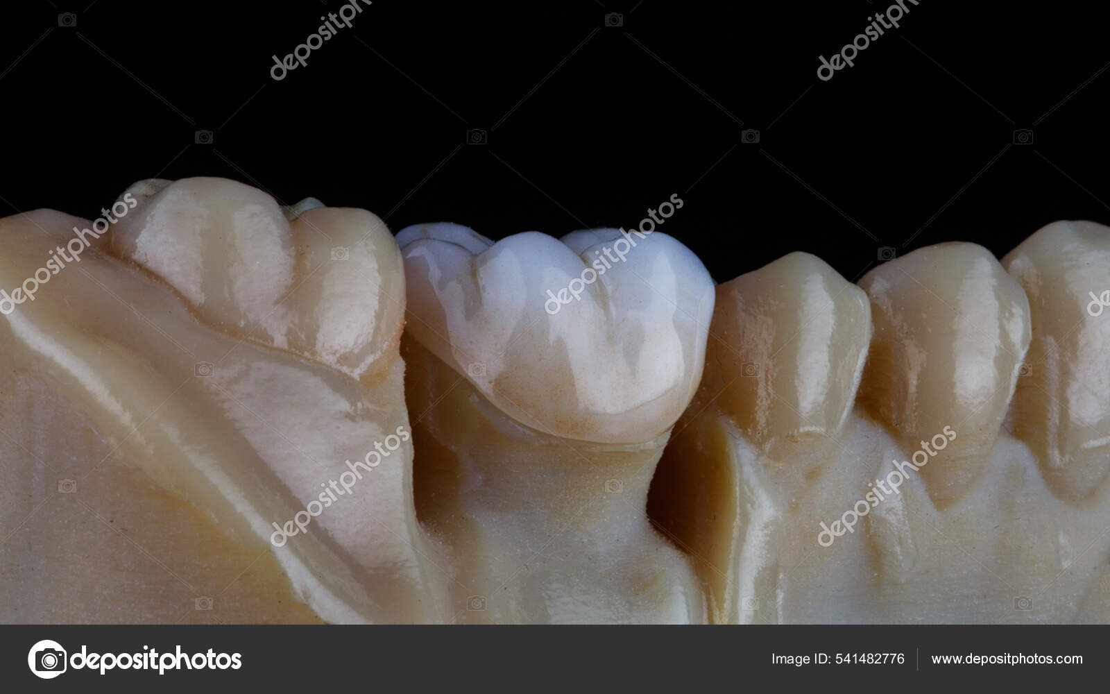 Zircon Crown Chewing Tooth Resin Model Black Background Stock Photo by ...