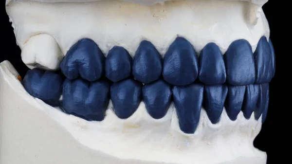 Teeth anatomy Stock Photos, Royalty Free Teeth anatomy Images ...