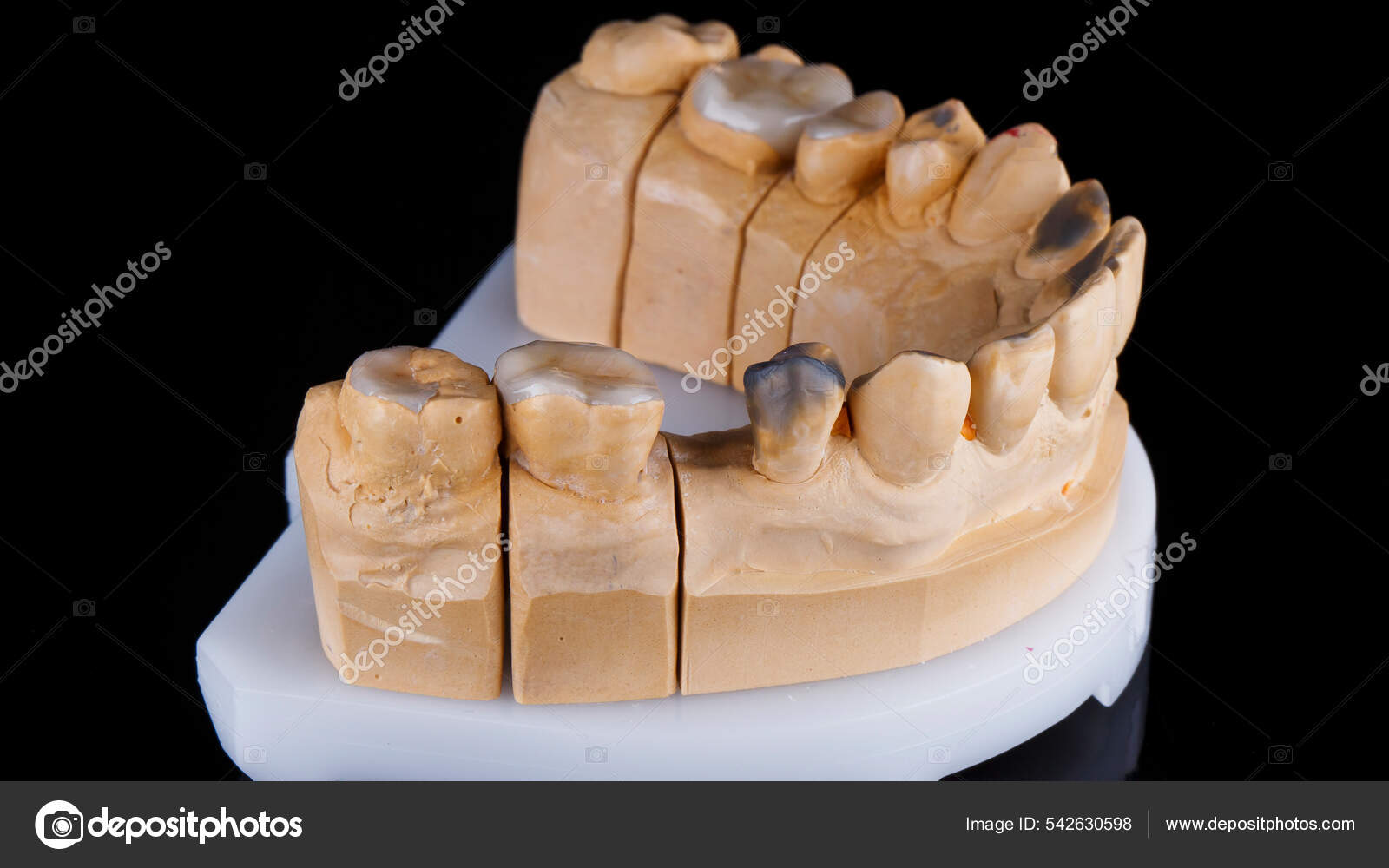 Dental Model Jaw Ceramic Tabs Black Background — Stock Photo ...