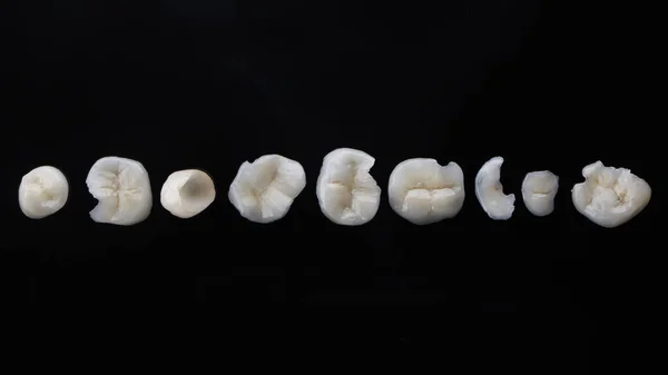 composition of dental ceramic tabs on a black background, top view ...