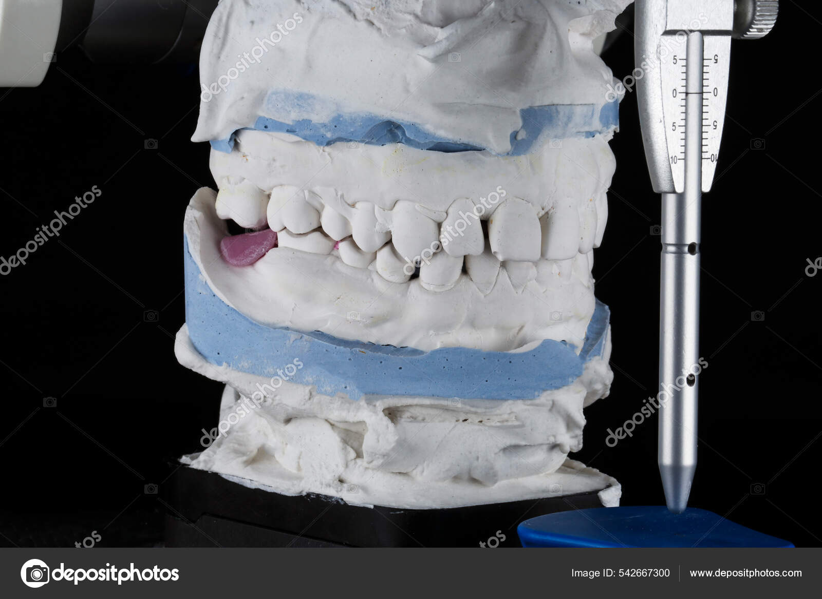 Bite Measurement Using Gypsum Jaw Model Dental Articulator — Stock ...