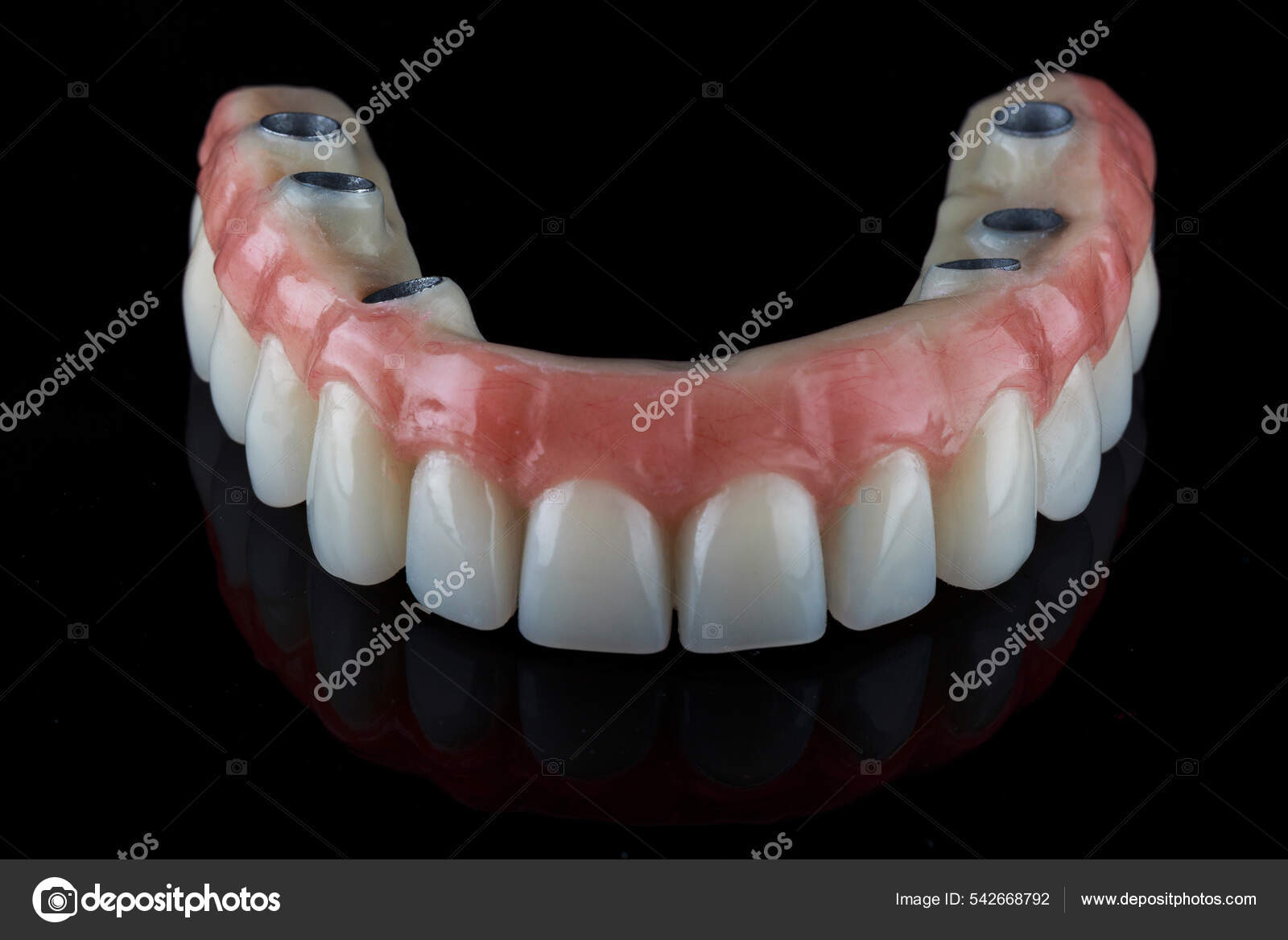 Dental Upper Jaw Prosthesis Fixation Six Implants Shot Black Background ...