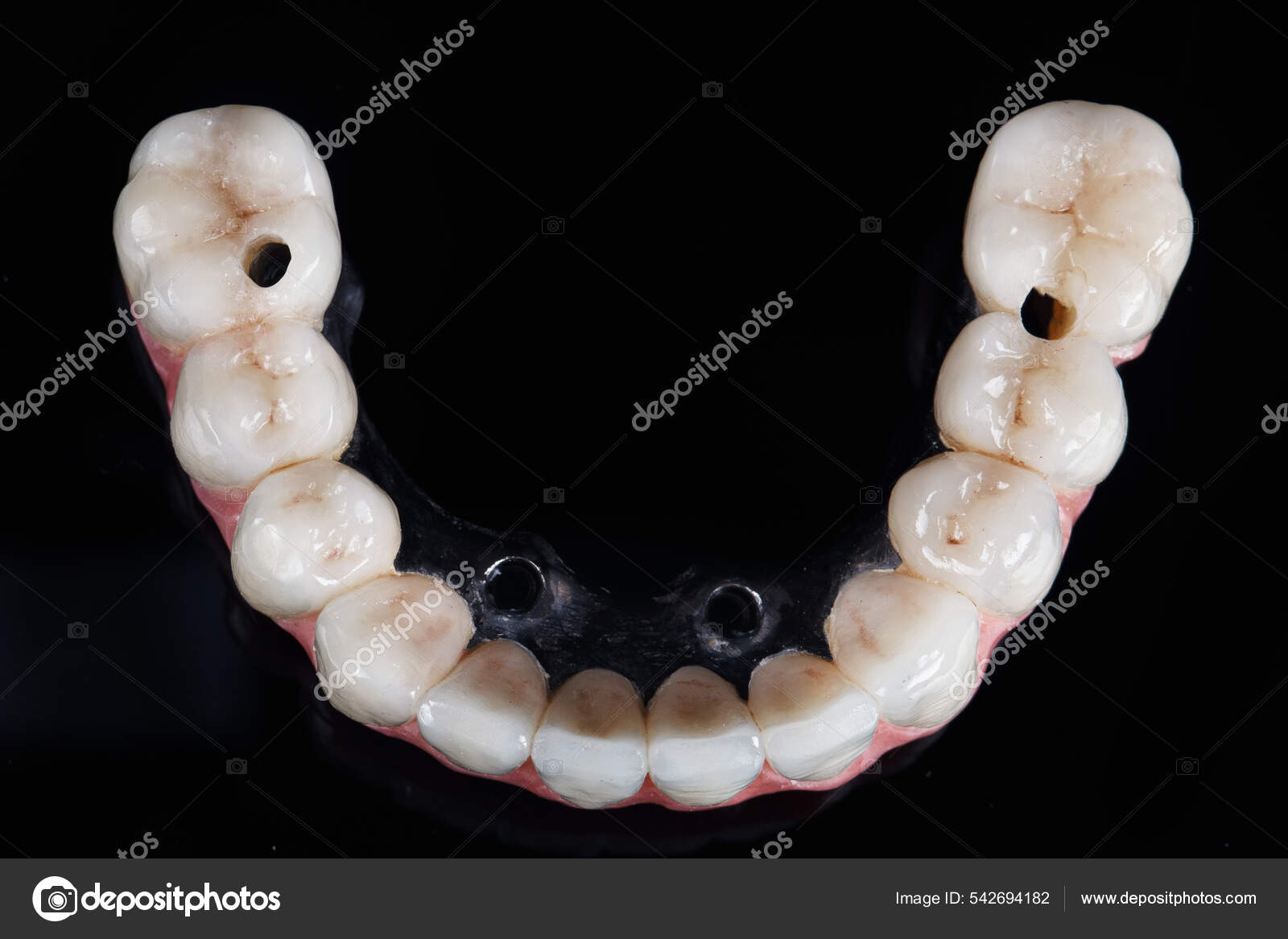Titanium Ceramic Denture Top View Black Background — Stock Photo ...